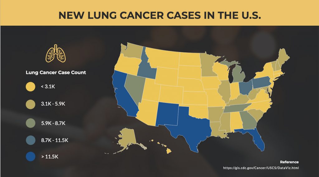 How to Make a Choropleth Map: 5-Step Guide for Beginners